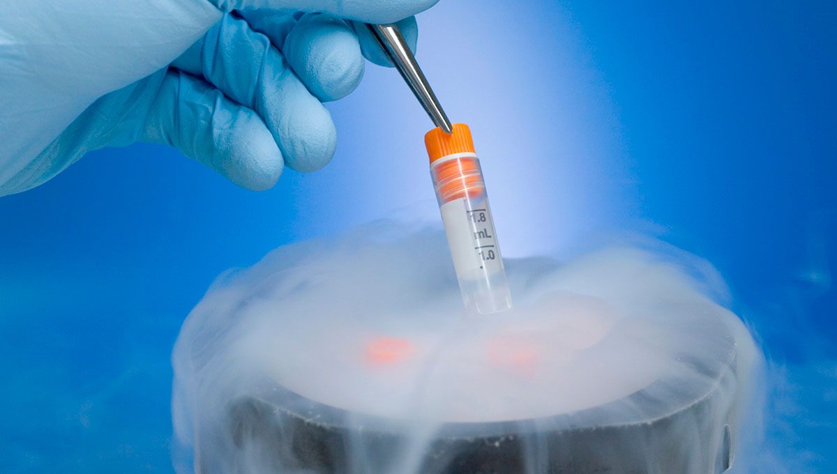 Congelación de Semen. Concibe. Clinica de fertilidad CDMX